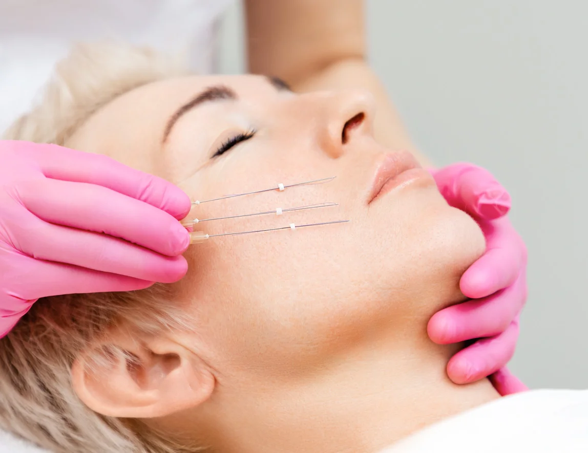 شد الوجه بالخيوط في دبي في عيادة نوفا